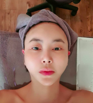 황혜영, 골기관리 받은 얼굴 "볼살 다 광대로 승천..못생겼다"[★SHOT!] - OSEN