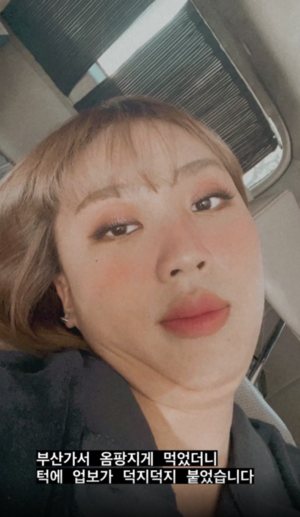 ‘12kg 감량’ 이영지, 두턱 인증 “옴팡지게 먹었더니 업보가 덕지덕지 붙어” - OSEN