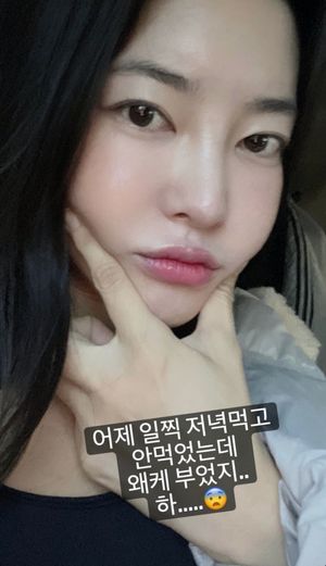 ‘최우성♥’ 김윤지, 결혼 후 5kg 쪘다더니 얼굴까지 퉁퉁 “왜 이렇게 부었지” - OSEN