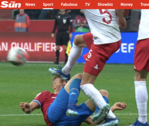 '충격적 장면' 웨스트햄 MF, 축구화에 이마 찍혀 '출혈+붕대 투혼'... 그와중에 '동점골' 작렬 - OSEN