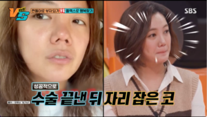 고은아 “코 재건수술→M자 모발 이식… 9시간 대수술, 중형차 1대 값” 깜짝 (‘강심장VS’) [Oh!쎈포인트] - OSEN