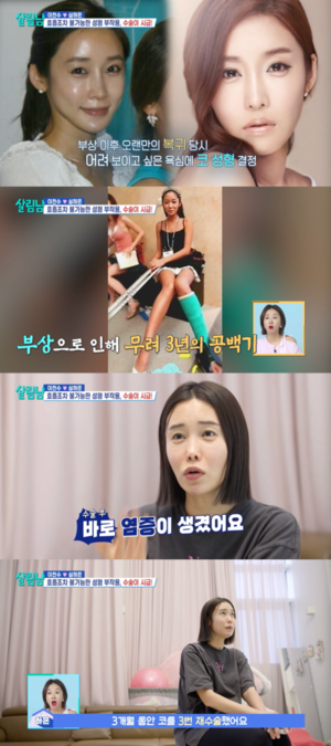 이천수, ‘코성형 부작용 10년째’ ♥︎심하은에 “징그러워” 막말→“말실수 했다” 사과[Oh!쎈 이슈] - OSEN