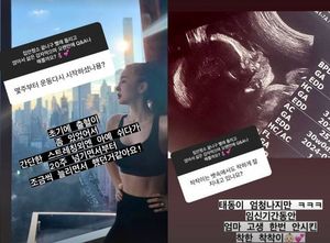 '이상해 며느리' 김윤지 "임신 후 12kg 증가...초기엔 운동하다 출혈도" - OSEN