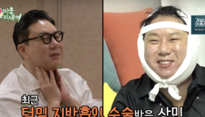 '턱밑 지방제거' 이상민, 확 살아난V라인..하지만 00있다? '반전' [Oh!쎈 리뷰] - OSEN
