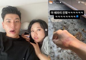 '홍현희♥' 제이쓴, 퉁퉁 부은 손에 '깜짝' "아 OOO 진짜" - OSEN