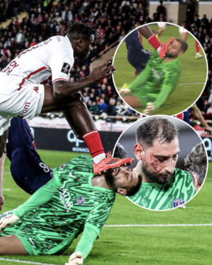 축구화 바닥으로 뺨 맞은 'LEE 동료' 돈나룸마... 가해자는 퇴장 NO→PSG 감독 "해치려는 의도 아니었을 것" - OSEN