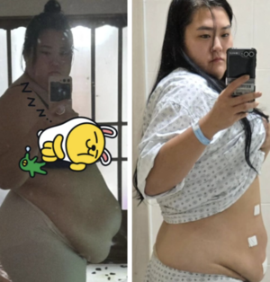 미나 시누이, 150→99kg '충격' 감량 전후..."팔에 혈관이 보여" - OSEN