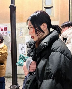 '40kg 저체중' 율희, 얼굴 상처에 깁스까지 만신창이…"살 좀 쪄요" 걱정 쇄도 - OSEN