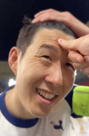 이마 긁힌 자국 클로즈업→"누가 밀어서 상처 났어요!" 장난스럽게 영광의 상처 '자랑한?' SON - OSEN