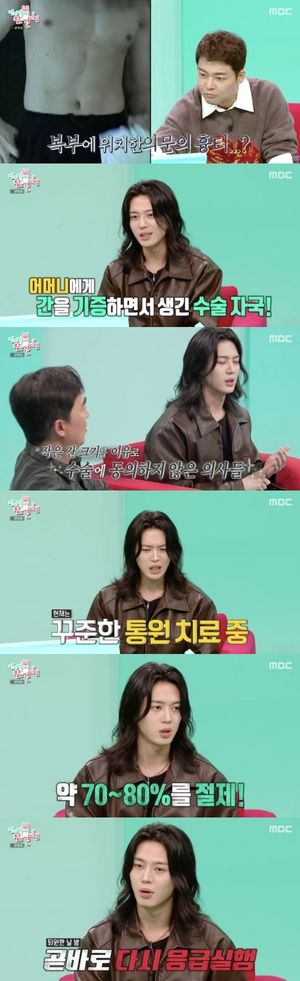 이주안, 배에 선명한 수술 자국 "간암 母 위해 간 80% 기증"(전지적참견시점)[핫피플] - OSEN