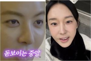 180도 확 달라졌다..'코성형' 강남→이지혜도 '인중축소술' 눈길 [핫피플] - OSEN