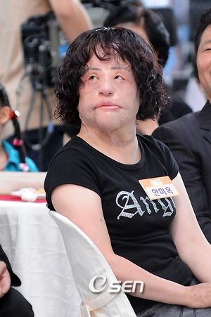 ‘선풍기 아줌마’ 故한혜경, 불법 성형시술로 부작용 겪다 사망…오늘(15일) 7주기[Oh!쎈 이슈] - OSEN